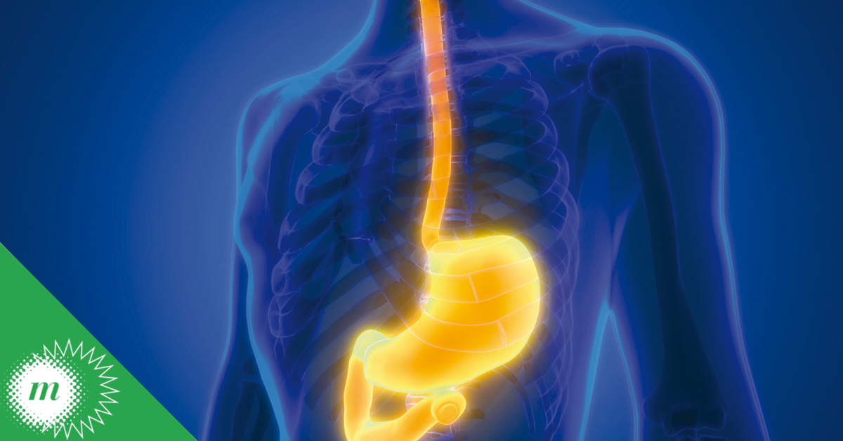 Esofago di Barrett. Una complicanza del reflusso esofageo | MultiMedica